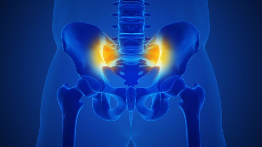 Sacroiliac Joint Injections Melbourne